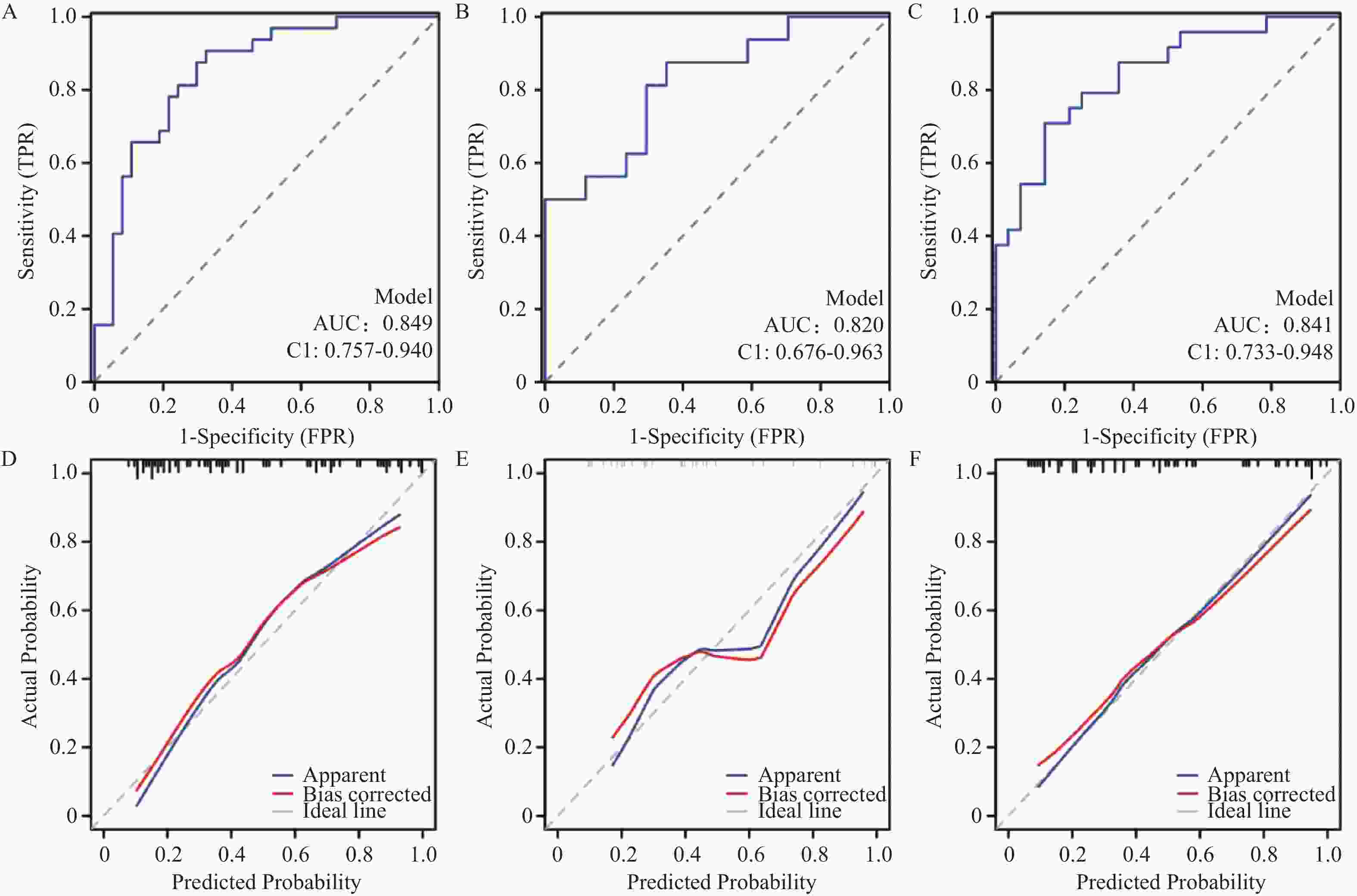 基于凝血功能指标构建初诊多发性骨髓瘤患者ISS高危分期预测模型